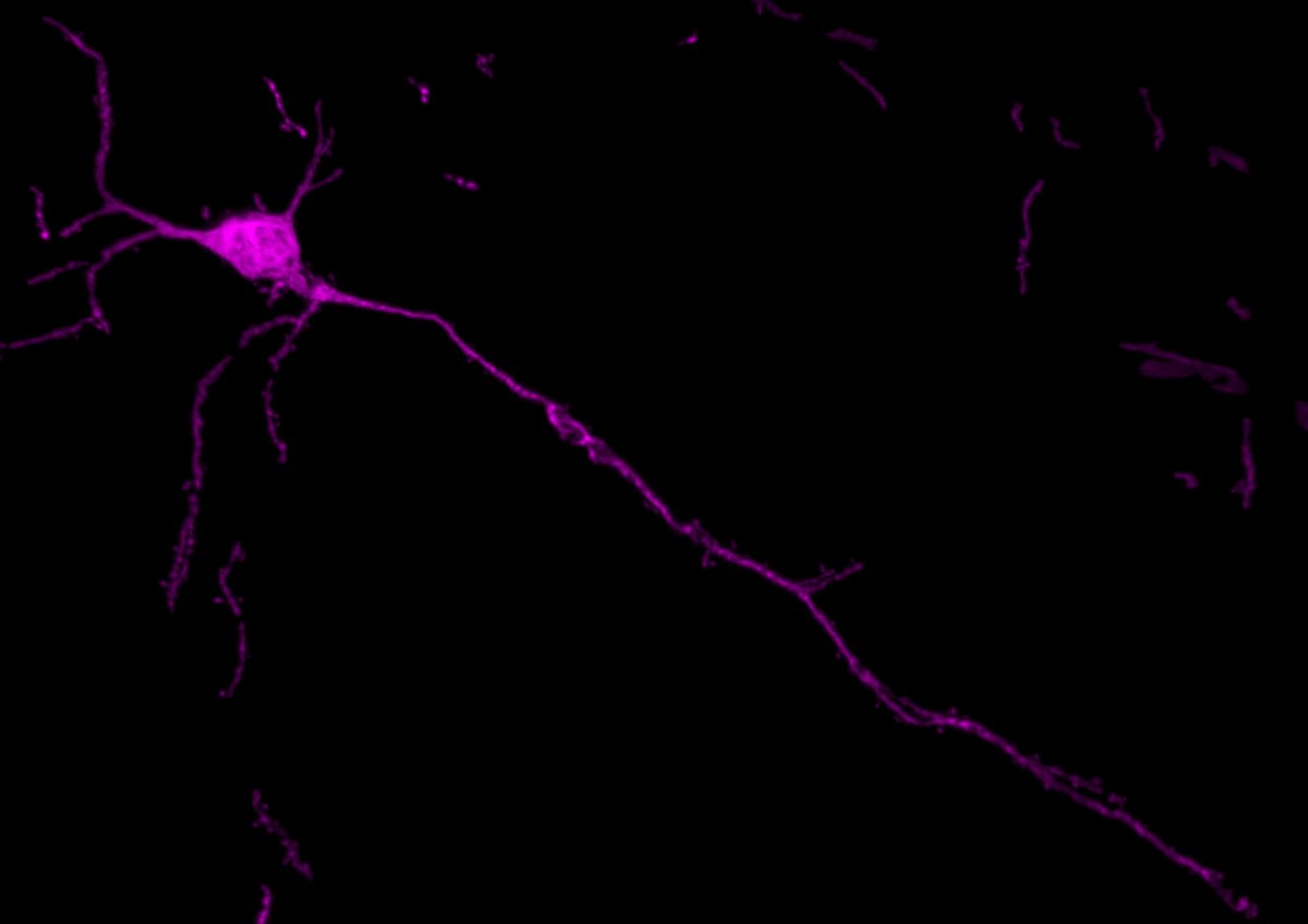 Neuroscience Research - Microscopy & Imaging Solutions - Andor - Oxford ...