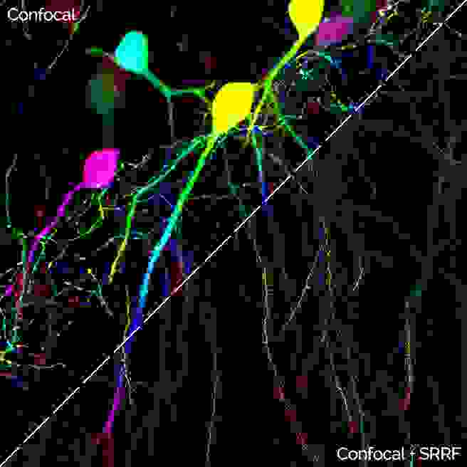 High Speed Confocal Microscope System | Dragonfly - Andor - Oxford ...