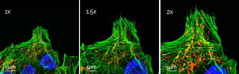 High Speed Confocal Microscope System | Dragonfly - Andor - Oxford ...