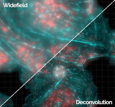 High Speed Confocal Microscope System | Dragonfly - Andor - Oxford ...