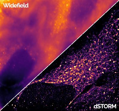 High Speed Confocal Microscope System | Dragonfly - Andor - Oxford ...