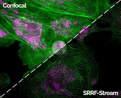 High Speed Confocal Microscope System | Dragonfly - Andor - Oxford ...