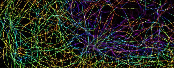 Dragonfly Confocal Microscope System - Andor - Oxford Instruments