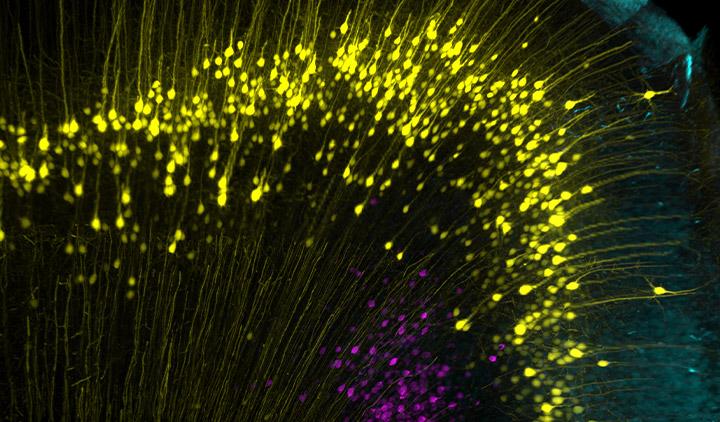 Dragonfly Confocal Microscope System - Andor - Oxford Instruments
