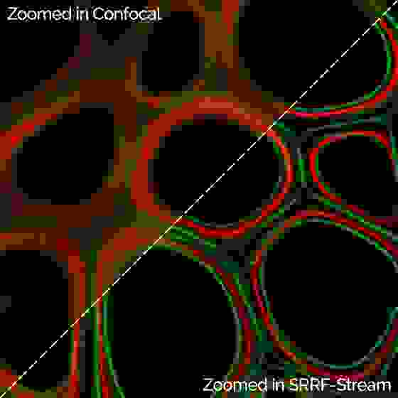 High Speed Confocal Microscope System | Dragonfly - Andor - Oxford ...