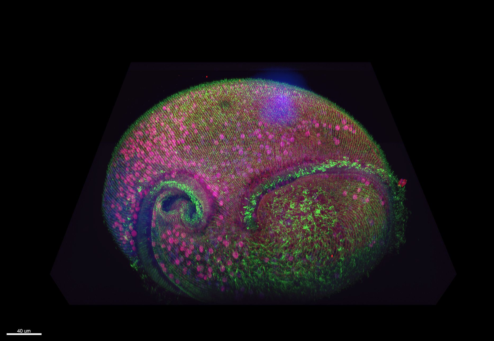 High Speed Confocal Microscope System | Dragonfly - Andor - Oxford ...