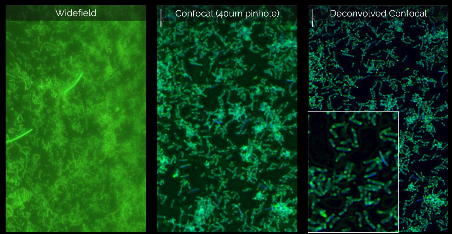 High Speed Confocal Microscope System | Dragonfly - Andor - Oxford ...
