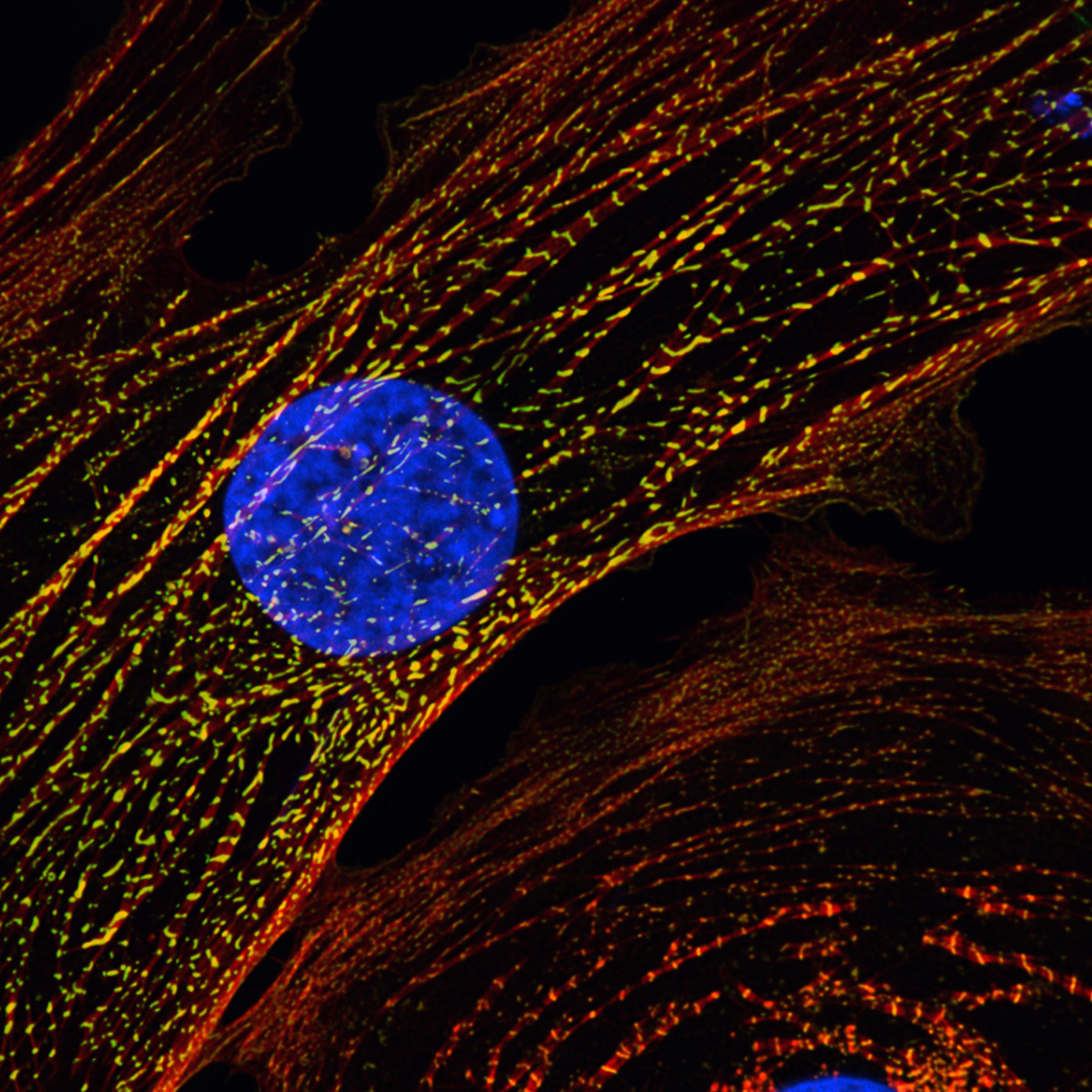 High Speed Confocal Microscope System | Dragonfly - Andor - Oxford ...