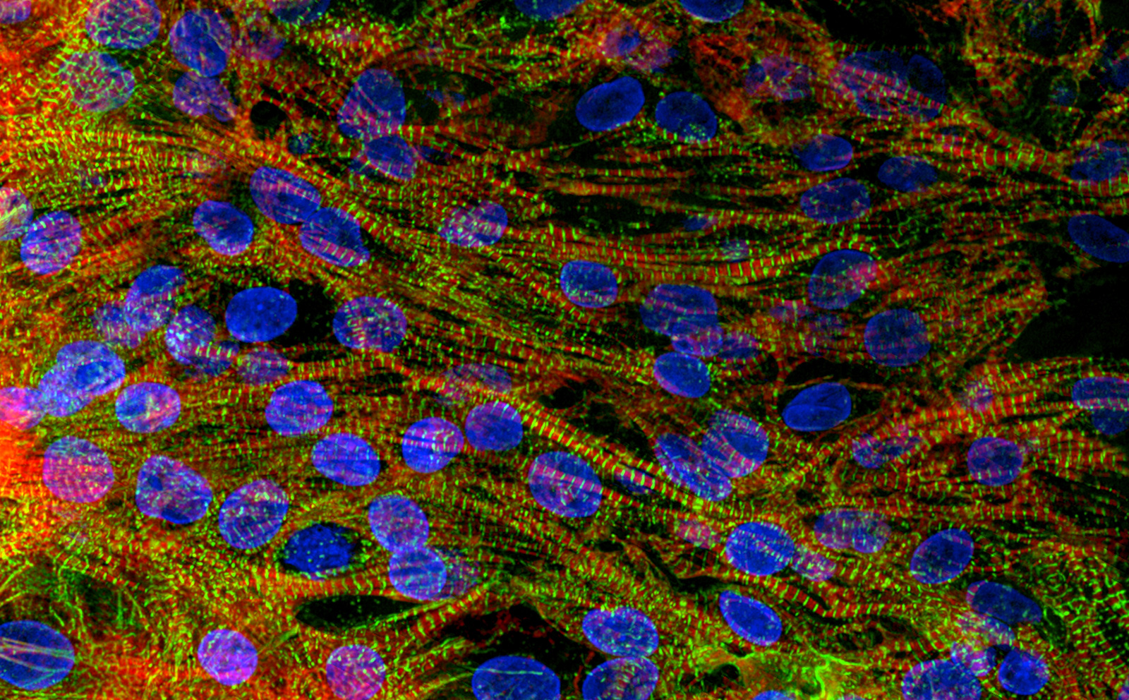 High Speed Confocal Microscope System | Dragonfly - Andor - Oxford ...