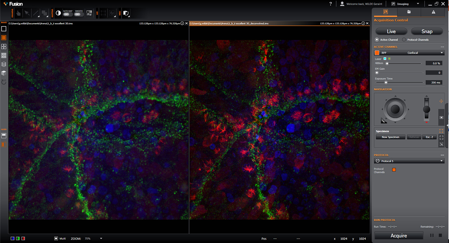 High Speed Confocal Microscope System | Dragonfly - Andor - Oxford ...