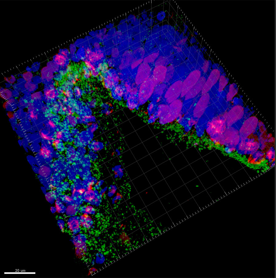 High Speed Confocal Microscope System | Dragonfly - Andor - Oxford ...