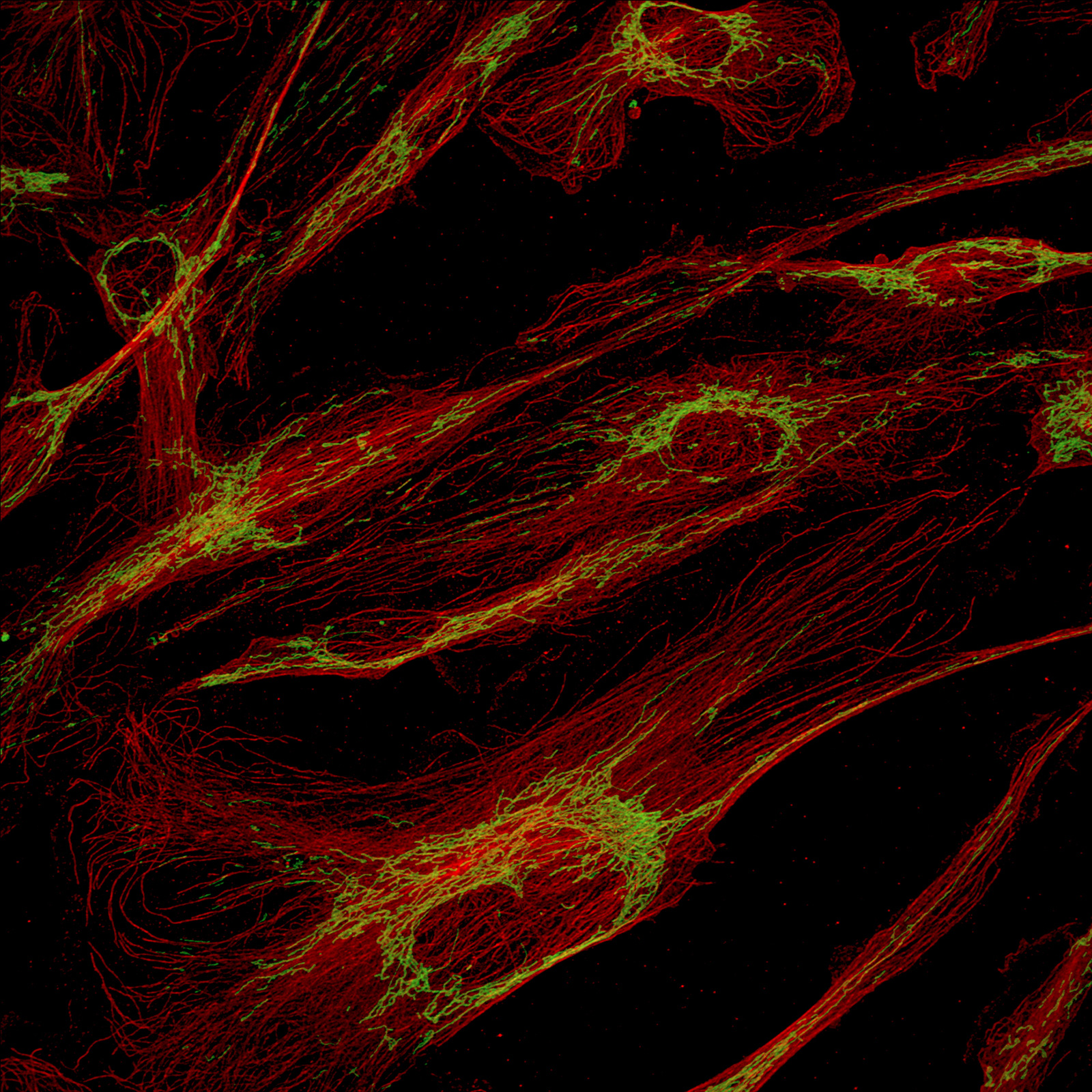 High Speed Confocal Microscope System | Dragonfly - Andor - Oxford ...