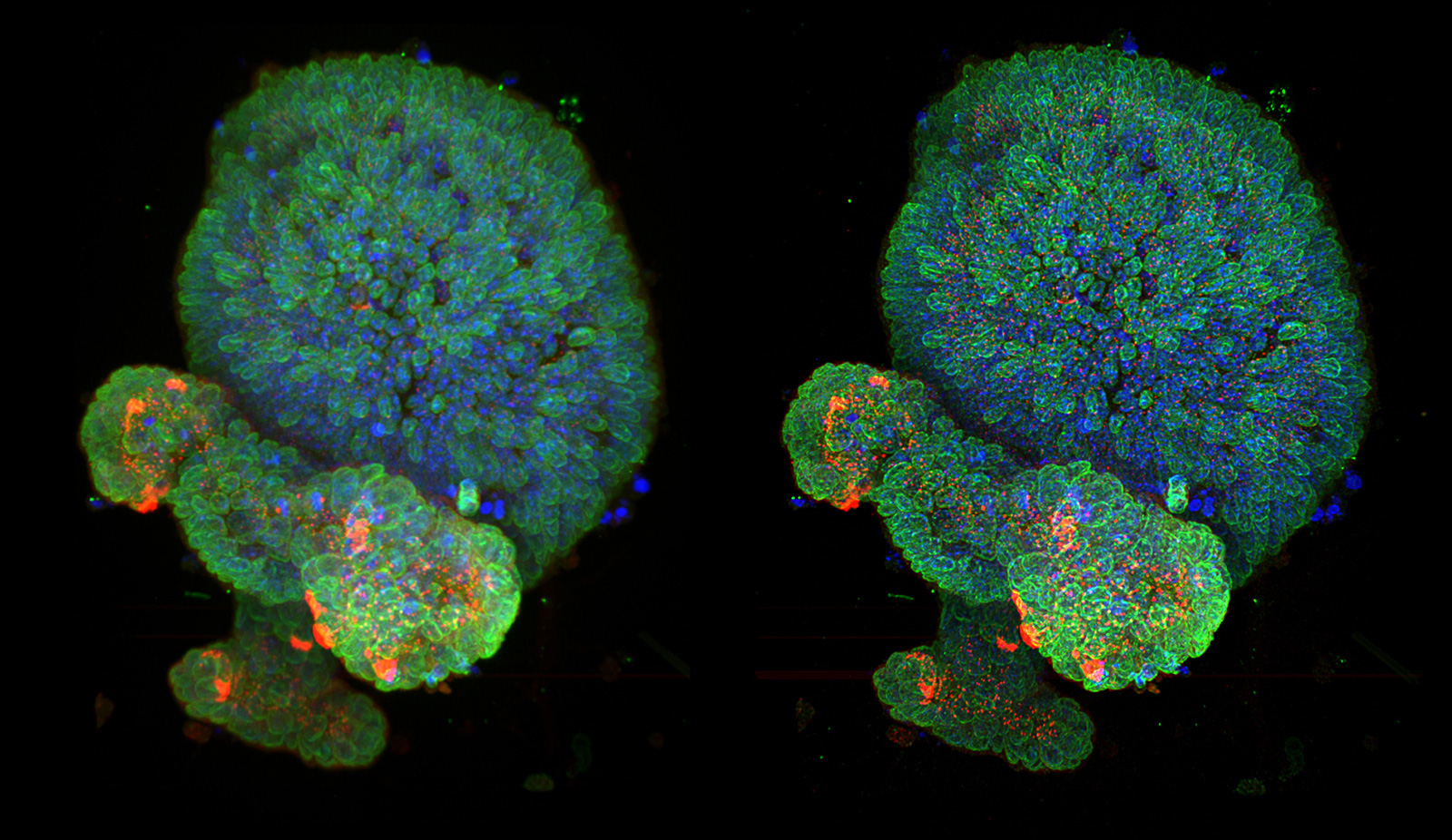 High Speed Confocal Microscope System | Dragonfly - Andor - Oxford ...